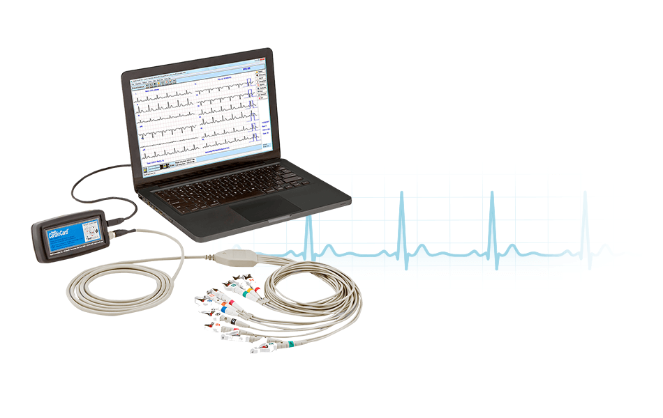ECG : Resting ECG from 1st Source To Meet Today's Telehealth Needs.