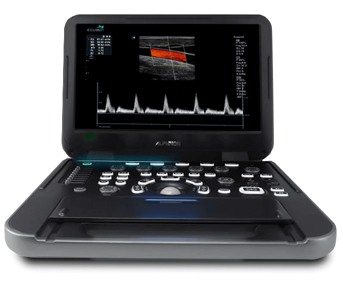 Ultrasound : Portable Ultrasound Brings Imaging Your Patients.